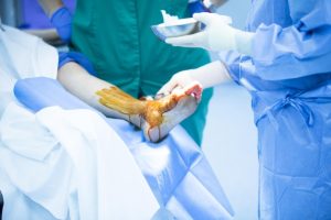 Tommy John Surgery, The Essential Procedure for UCL Reconstruction and ...